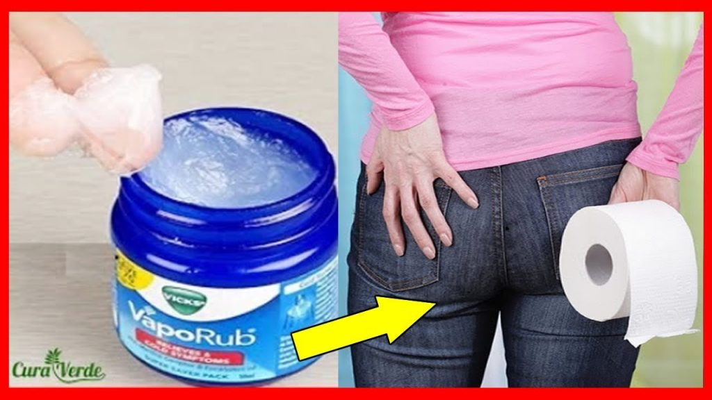 Diga Adeus As Hemorroidas Sem Cirurgia Apenas Usando Vick Vaporub